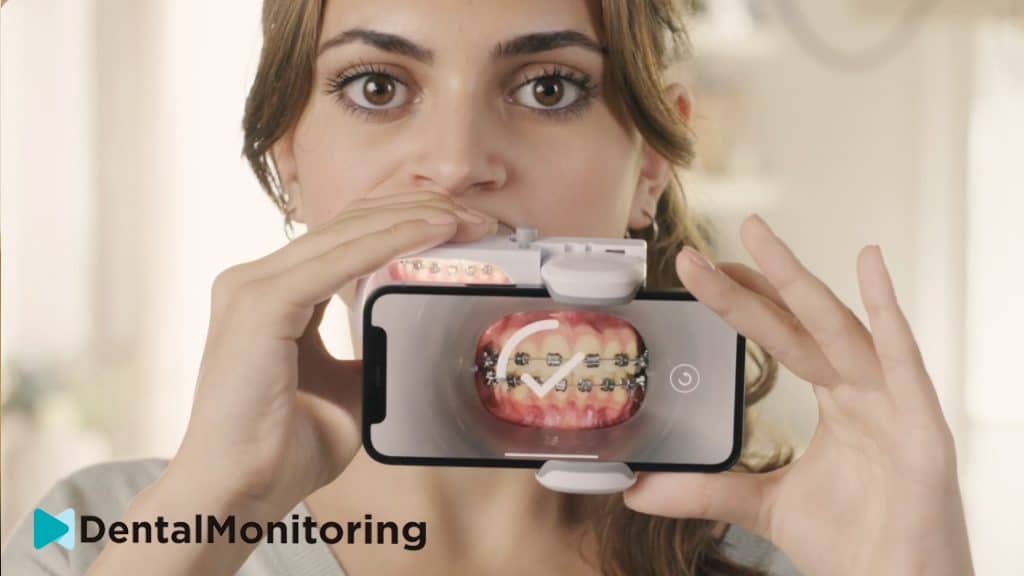 Remote Dental Monitoring in Los Altos & Cupertino, CA | Signature ...