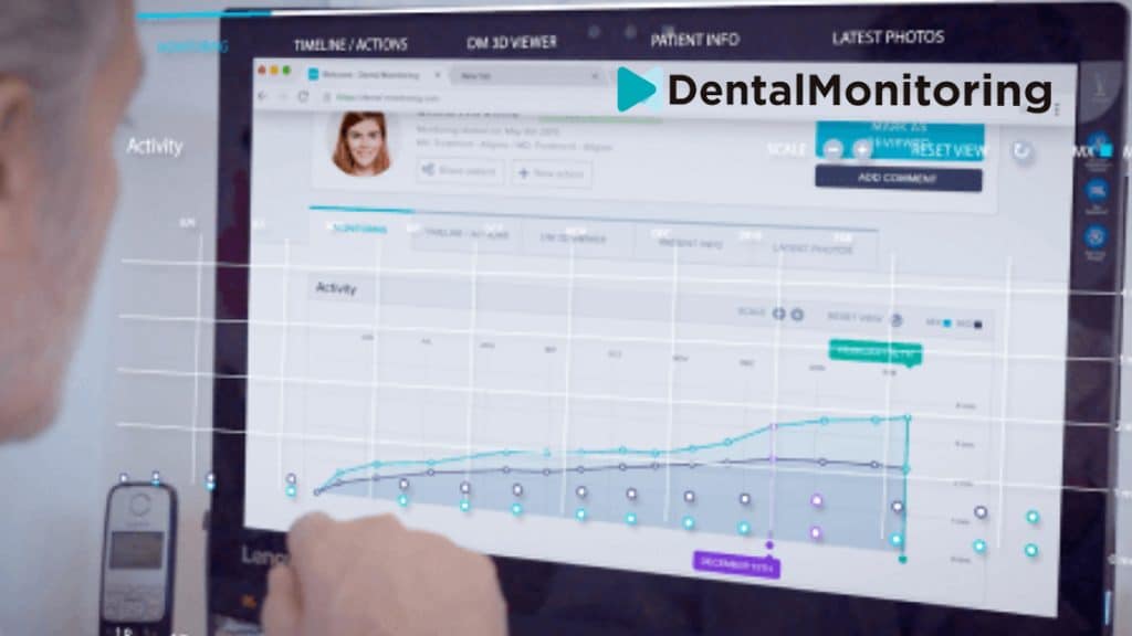 Remote Dental Monitoring in Los Altos & Cupertino, CA | Signature ...
